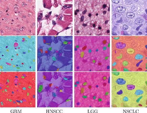 Panoptic Level Cell Segmentation Results Of Various Cancer Categories