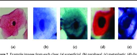 Specification Of Five Classes Of Cells Obtained From The Sipakmed Download Scientific Diagram
