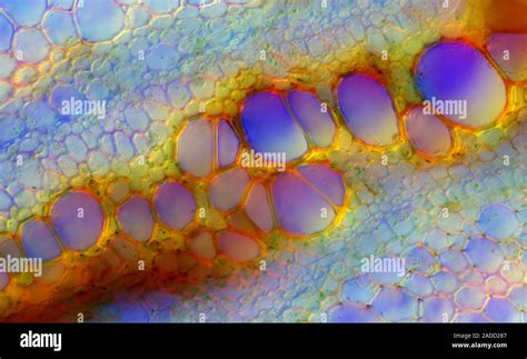 Fern Stem Rheinberg Illuminated Polarised Light Micrograph Of A Transverse Section Through A