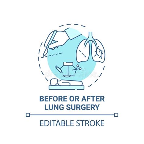 Lung Cancer Resection Stock Illustrations 20 Lung Cancer Resection
