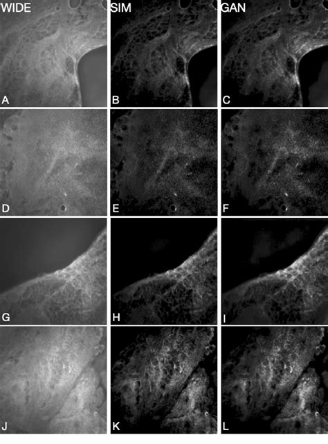 Figure 8 From Deep Learning 2d And 3d Optical Sectioning Microscopy