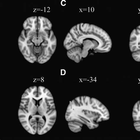 Clusters Showing Statistically Significant Between Group Differences In