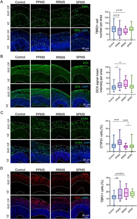 Cerebral Organoids In Primary Progressive Multiple Sclerosis Reveal Stem Cell And
