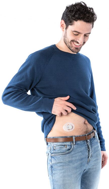 Cgm Сензор за измерване на кръвна захар GlucoМen Day диабет