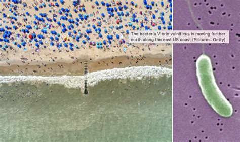‘flesh Eating Bacteria That Kills Almost One In Five Infected