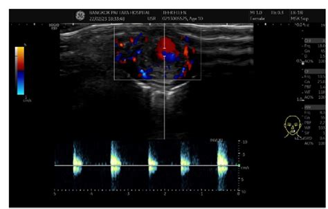 Color Doppler Ultrasound Download Scientific Diagram
