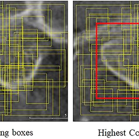 Object Detection Was Achieved Using A Single Regression Model From The Download Scientific