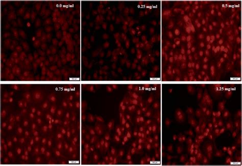 Photomicrographs Of Caco 2 Cells Stained With PI Dye Under A Phase