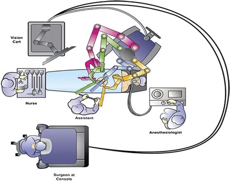 Robot Assisted Right Colectomy With Lymphadenectomy And Intr