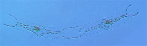 Hemiaulus Hauckii Light Micrograph Hemiaulus Hauckii Is … Flickr