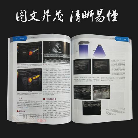 外周神经阻滞与超声介入解剖第2版简装版附英文原版超声引导下神经阻滞操作DVD李泉译北京大学医学出版社局部麻醉与镇痛领域 虎窝淘