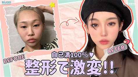韓国フル整形で激変♥自己満100％！！目整形＆鼻整形＆輪郭（頬骨）韓国da美容外科 Youtube