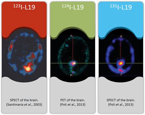 Human Fibronectin Extra Domain B As A Biomarker For Targeted Therapy In Cancer Pmc