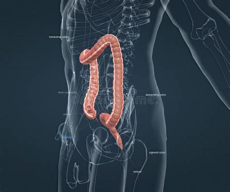 Appendicitis Is A Painful Swelling Of The Appendix Stock Illustration