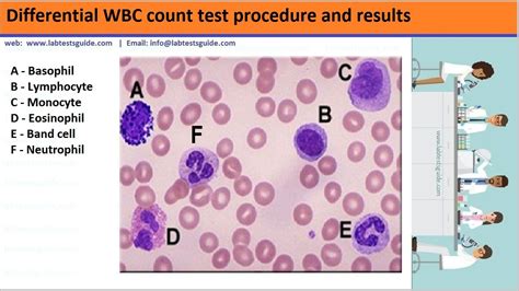 Manual Wbc Differential Count Procedure At Nicholas Bruny Blog