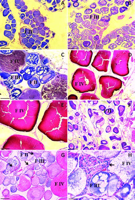 Histological Sections Of Female Gonads Of L Catesbeianus In Detail