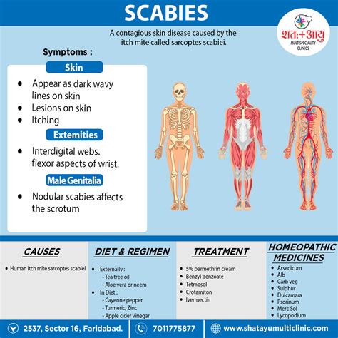 Scabies Shatayu Multi Speciality Clinic