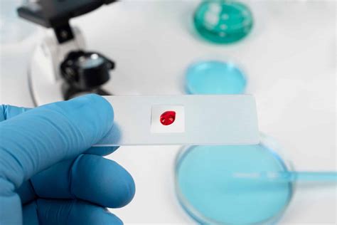 Std Vs Sti Differences Symptoms And Testing Equality Health