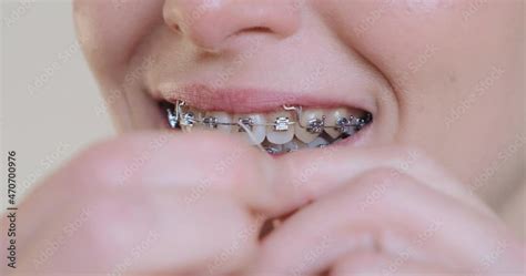 Woman Using Dental Floss Close Up Smiling Female Cropped Face With