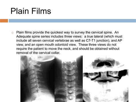 C Spine Positioning Pptx