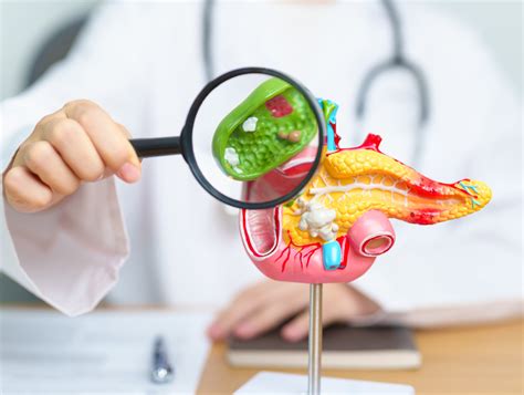 Gallstones Symptoms Causes And Treatment Dr Calvin Ong