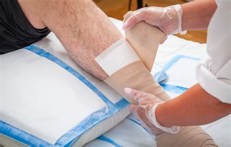 Guiding To Venous Leg Ulcer Management And Compression Therapy