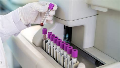 Résultats de laboratoire précisions sur les enjeux de transmission