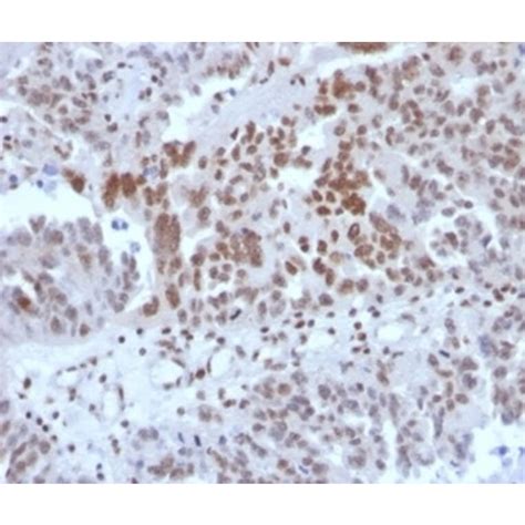 Anti-SP100 Antibody [PCRP-SP100-1B9] (A277802) | Antibodies.com