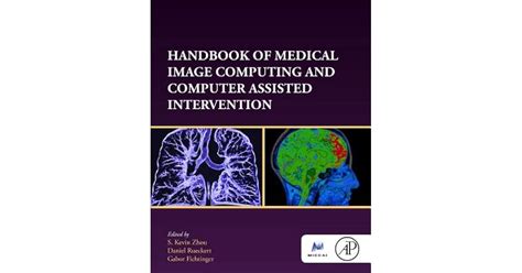Handbook Of Medical Image Computing And Computer Assisted Intervention By Kevin Zhou