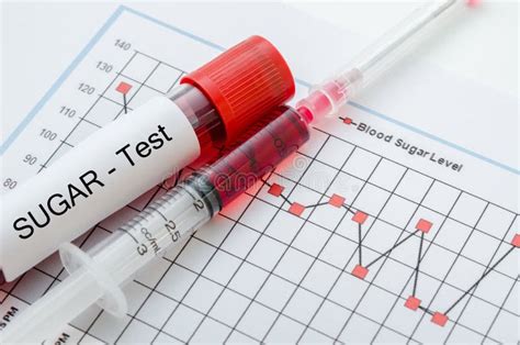 Sample Blood For Screening Diabetic Test Stock Image Image Of Exam
