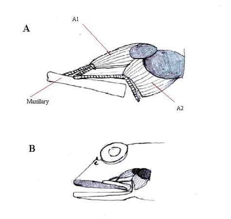 5 The Adductor Mandibulae Muscles Of Members Of The Genus Triglops A