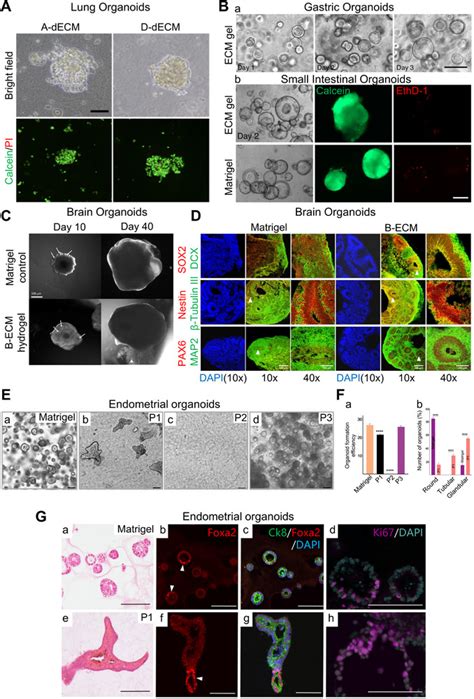 Bioactive Scaffolds For Tissue Engineering A Review Of Decellularized Extracellular Matrix