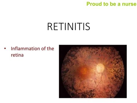 Retinitispptx