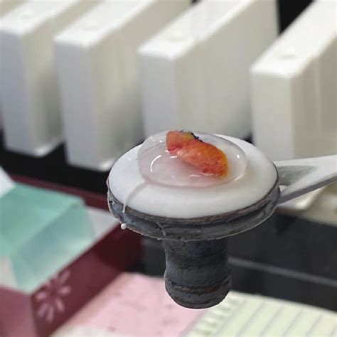 The Tissue Is Embedded In Optimal Cutting Temperature Oct Compound Download Scientific