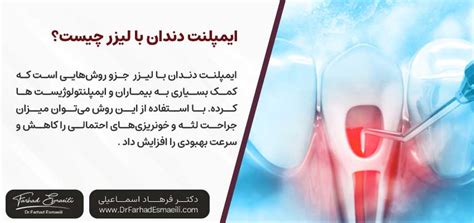 ایمپلنت دندان با لیزر در اصفهان قیمت ایمپلنت سال 1401 دکتر فرهاد اسماعیلی