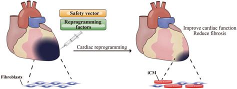 Direct Cardiac Reprogramming ― Converting Cardiac Fibroblasts To