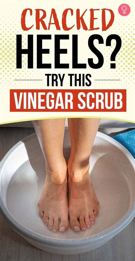 Diy Foot Scrub For Cracked Heels Artofit