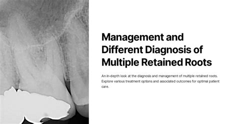 Management And Different Diagnosis Of Multiple Retained Roots