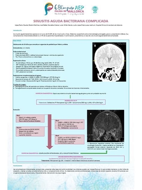 Sinucitis Cronica Bacteriana Pdf Dolor De Cabeza Medicina Clinica