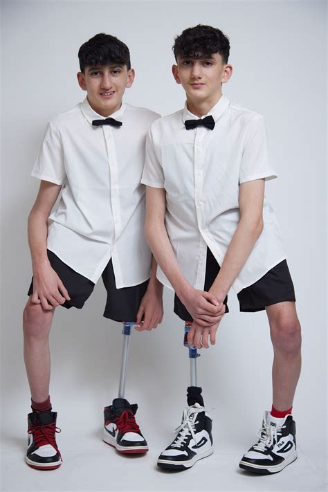Hassanandhussein H Zbd Talent Models With Disabilities Visible Differences And Trans And Non Binary
