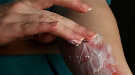 Bacoderm Krem Nedir Ve Bacoderm Ne İçin Kullanılır Bacoderm Krem