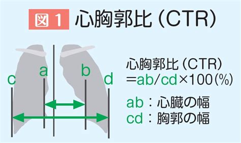 透析療法における ドライウェイトのお話 京都 西陣病院のホームページです