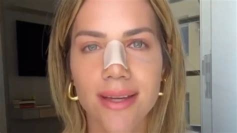 Gio Ewbank Exibe Novo Nariz Em Selfie Encantadora No Espelho