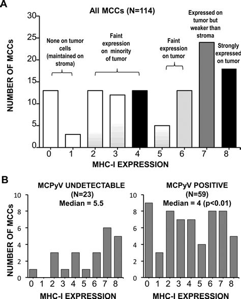 MHC I Downregulation Is Frequent In Human MCC Tumors A MHC I Protein