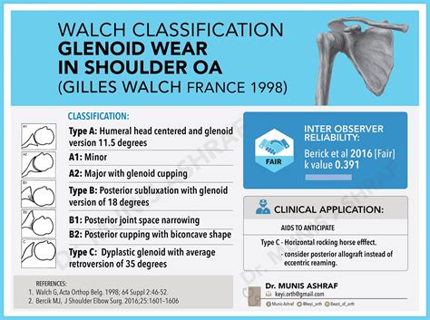 Orthopaedic Classifications And Current Concept Reviews