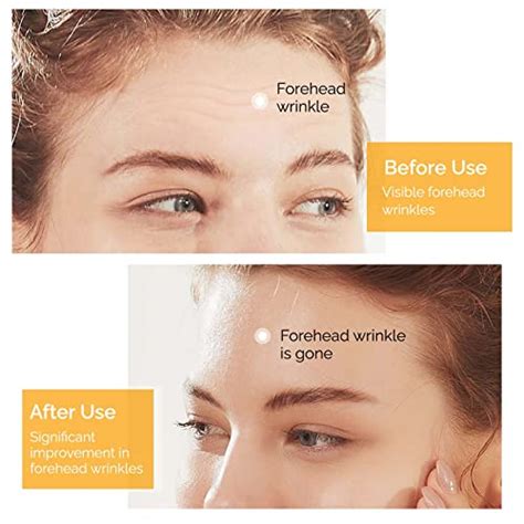 Forehead Wrinkle Patches Face Wrinkle Patches Smooth Forehead To