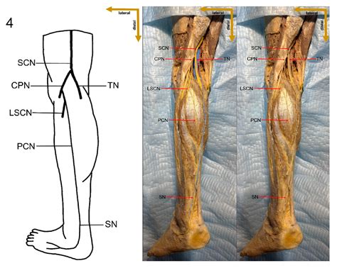 Sural Nerve Surface Anatomy