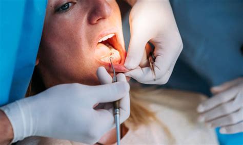 Impact Of Acidic Foods On Dental Enamel Key Insights