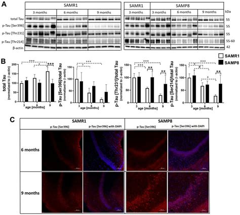 Hyperphosphorylation Of Tau Protein In The Hippocampi Of Samp8 Mice A