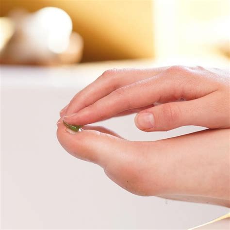 Nagelbettentzündung Ursachen Behandlung ilon de